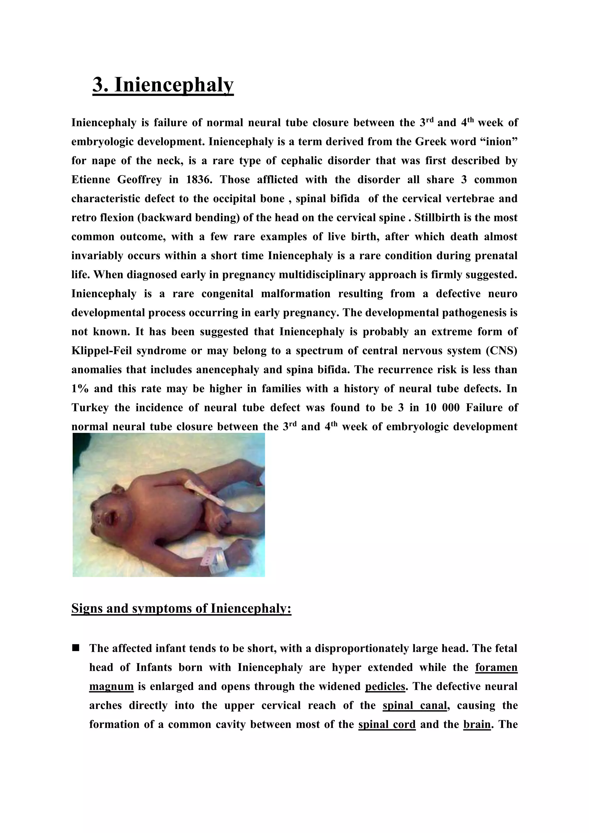 Neural tube defects | DOCX