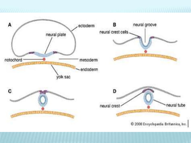Neural tube defects | PPTX