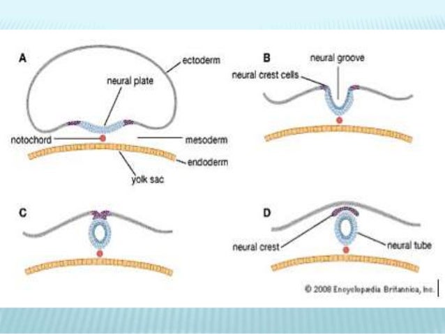 Neural tube defects