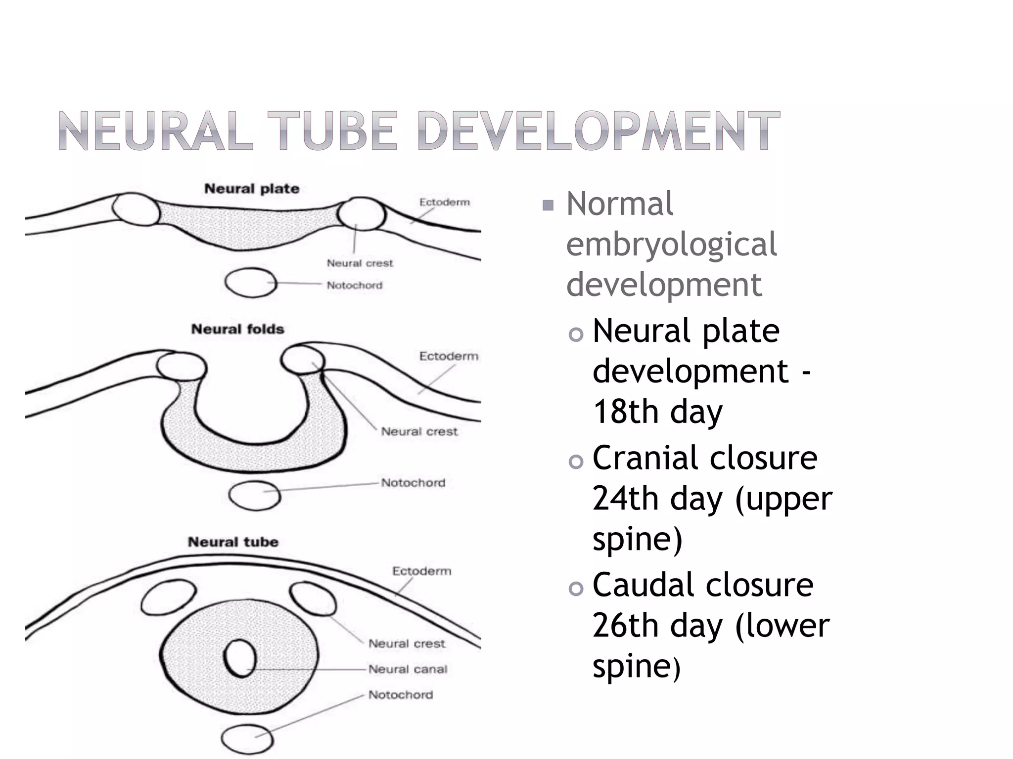 Neural tube defects | PPTX