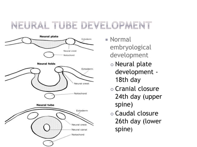 Neural tube defects
