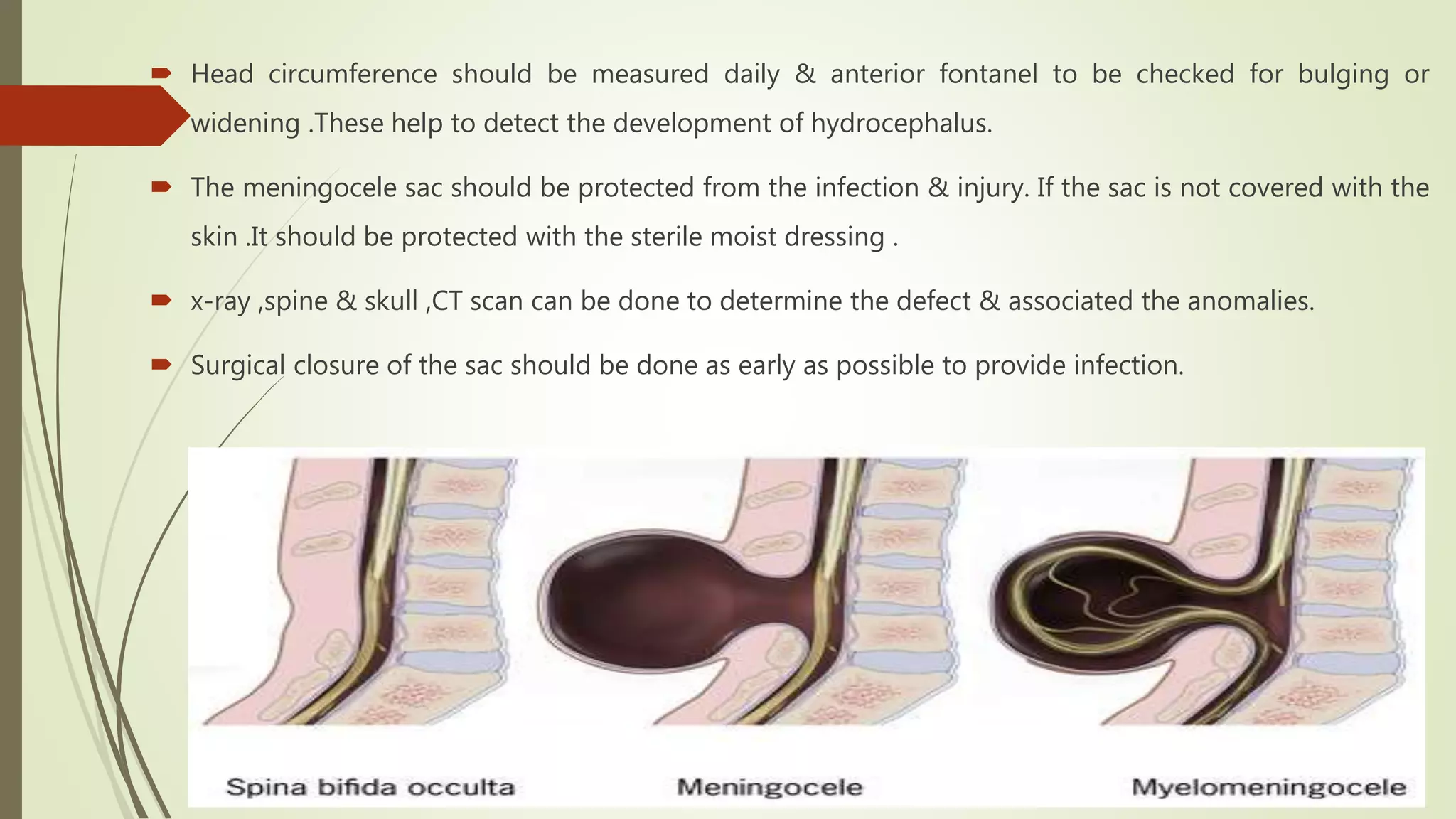 Neural tube defects | PPTX