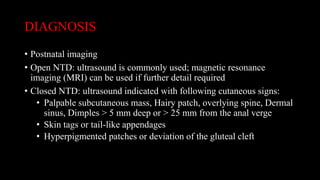 NEURAL TUBE DEFECTs.pptx