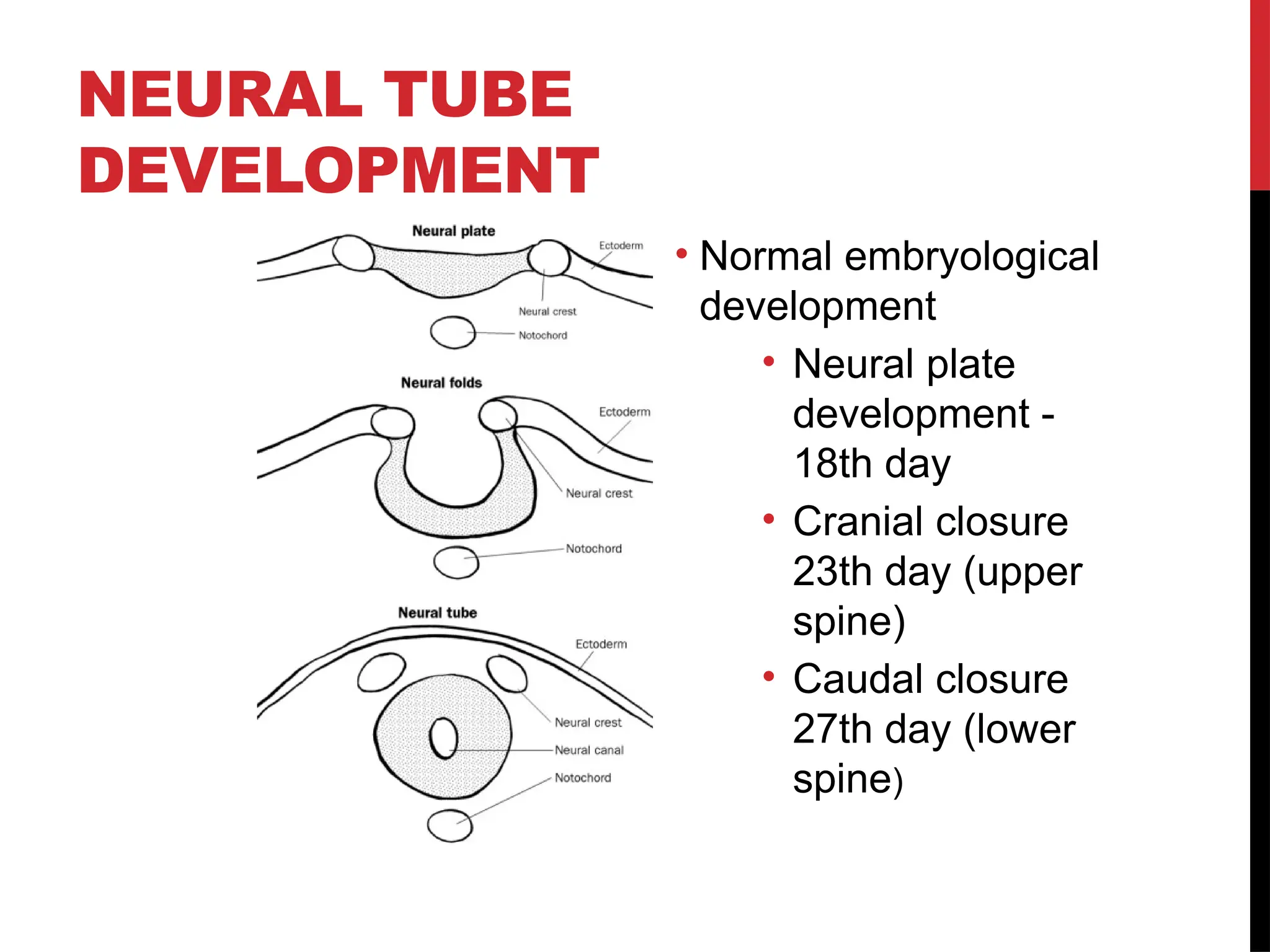 Neural Tube Defects.pptx all associated disorders are included | PPT