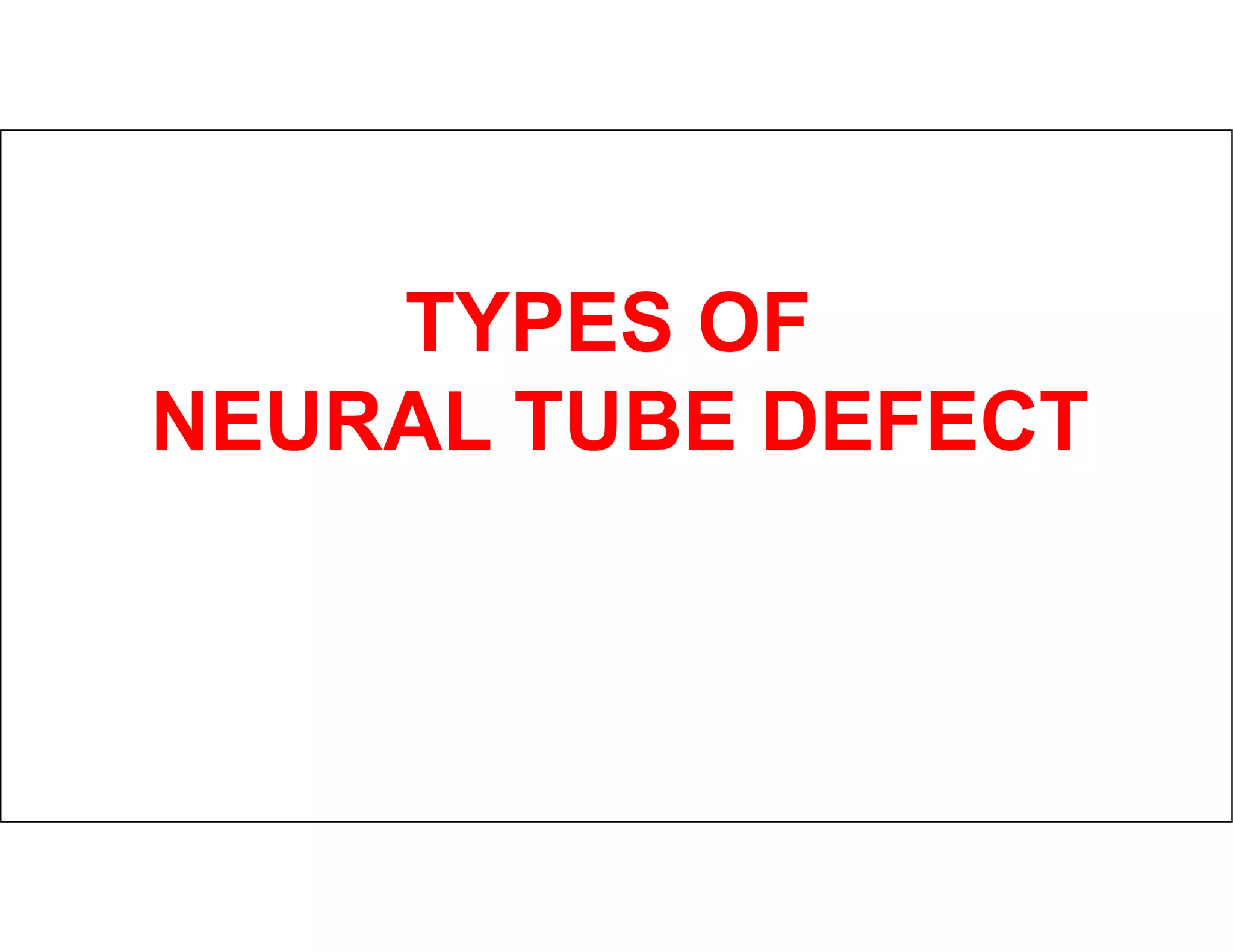 Neural tube defects and the role of folic acid in Lowering the Risk.pdf