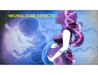 Neural tube defects and the role of folic acid in Lowering the Risk.pdf