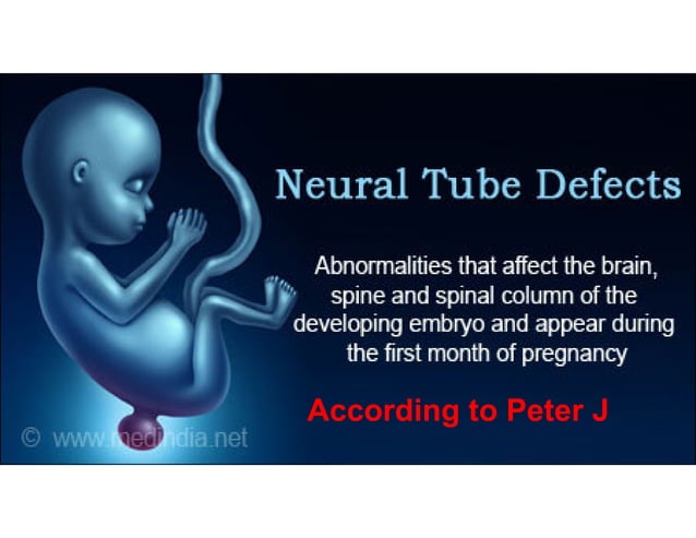 Neural tube defects and the role of folic acid in Lowering the Risk.pdf ...