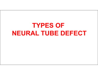 Neural tube defects and the role of folic acid in Lowering the Risk.pdf ...