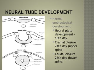 The Neural Tube Defects most recently 4.pptx