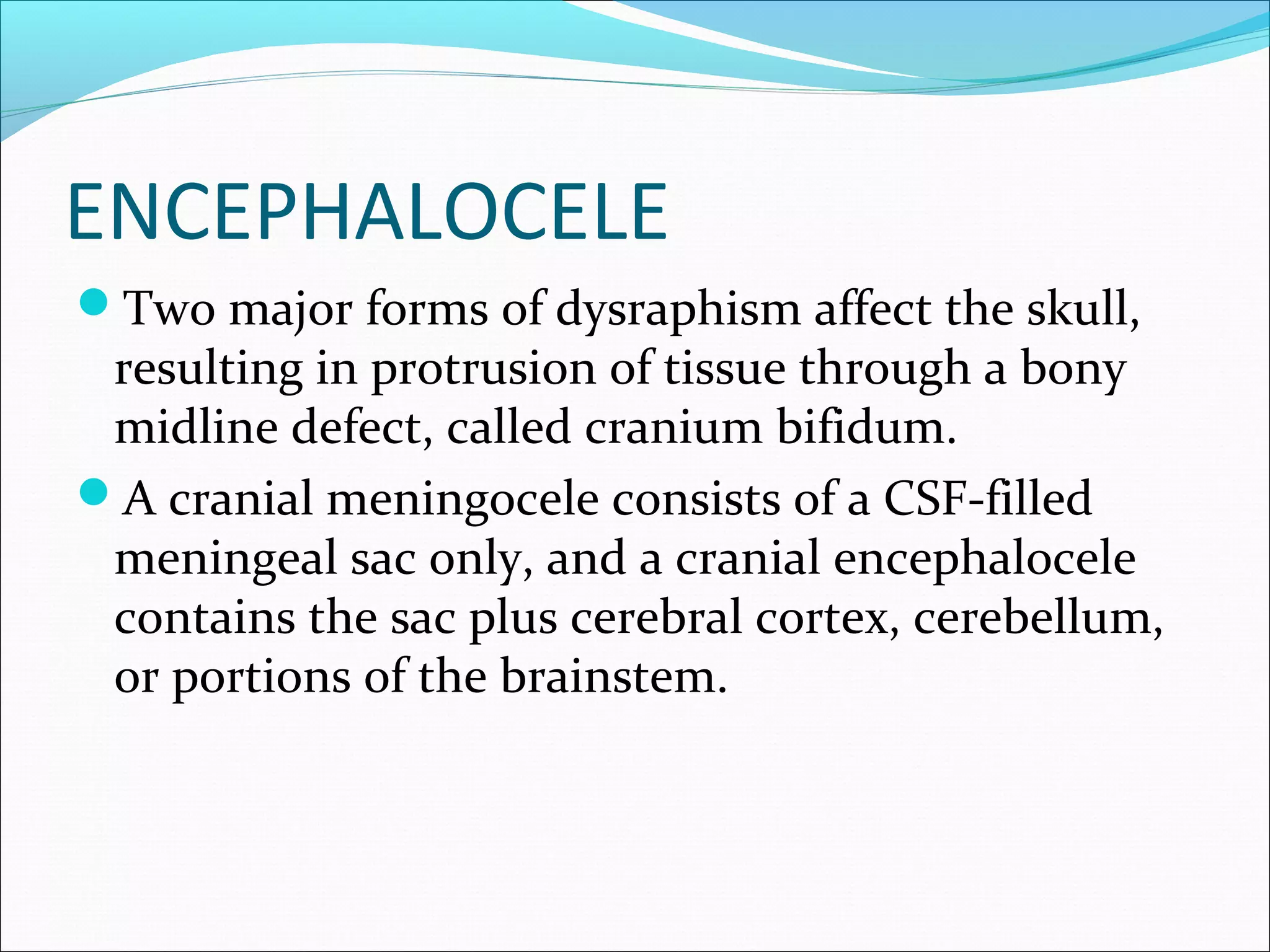 Neural tube defects | PPT