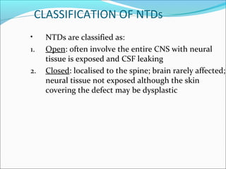Neural tube defects | PPT