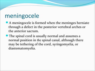 Neural tube defects | PPT