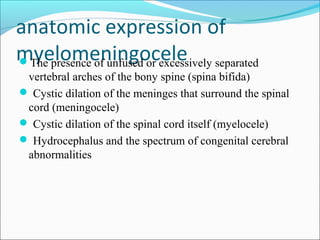 Neural tube defects | PPT