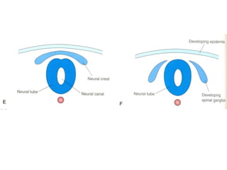 Neural tube dev | PPT