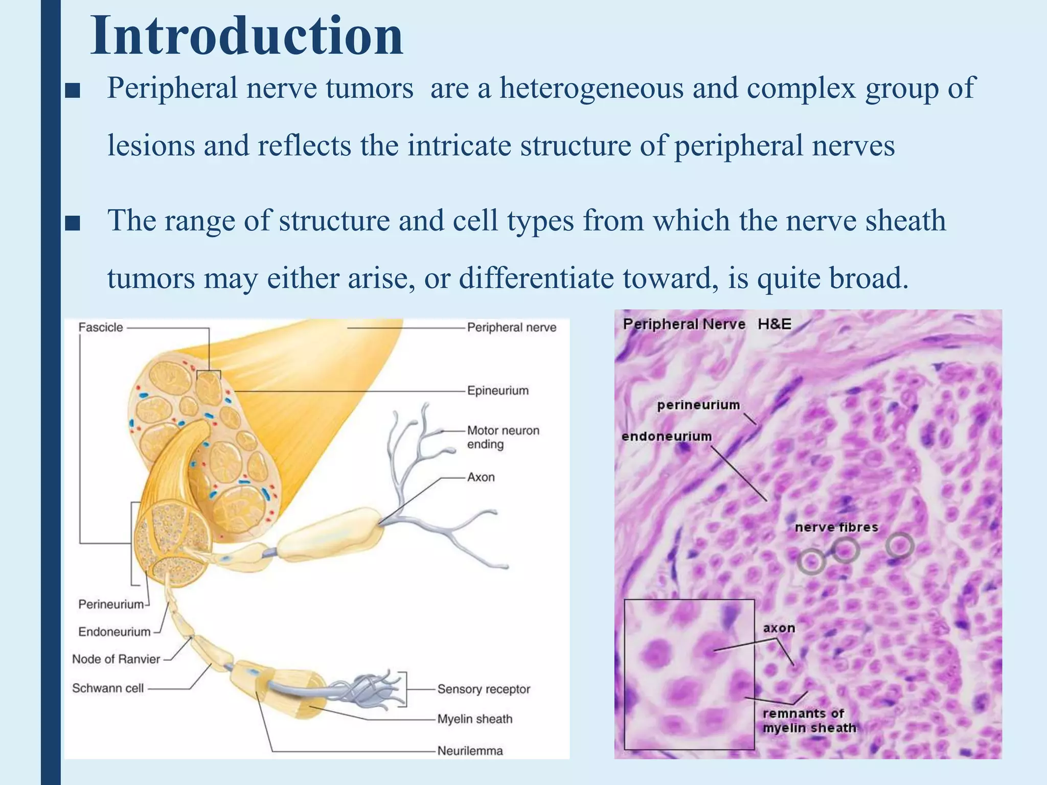 Neural tumors | PPTX