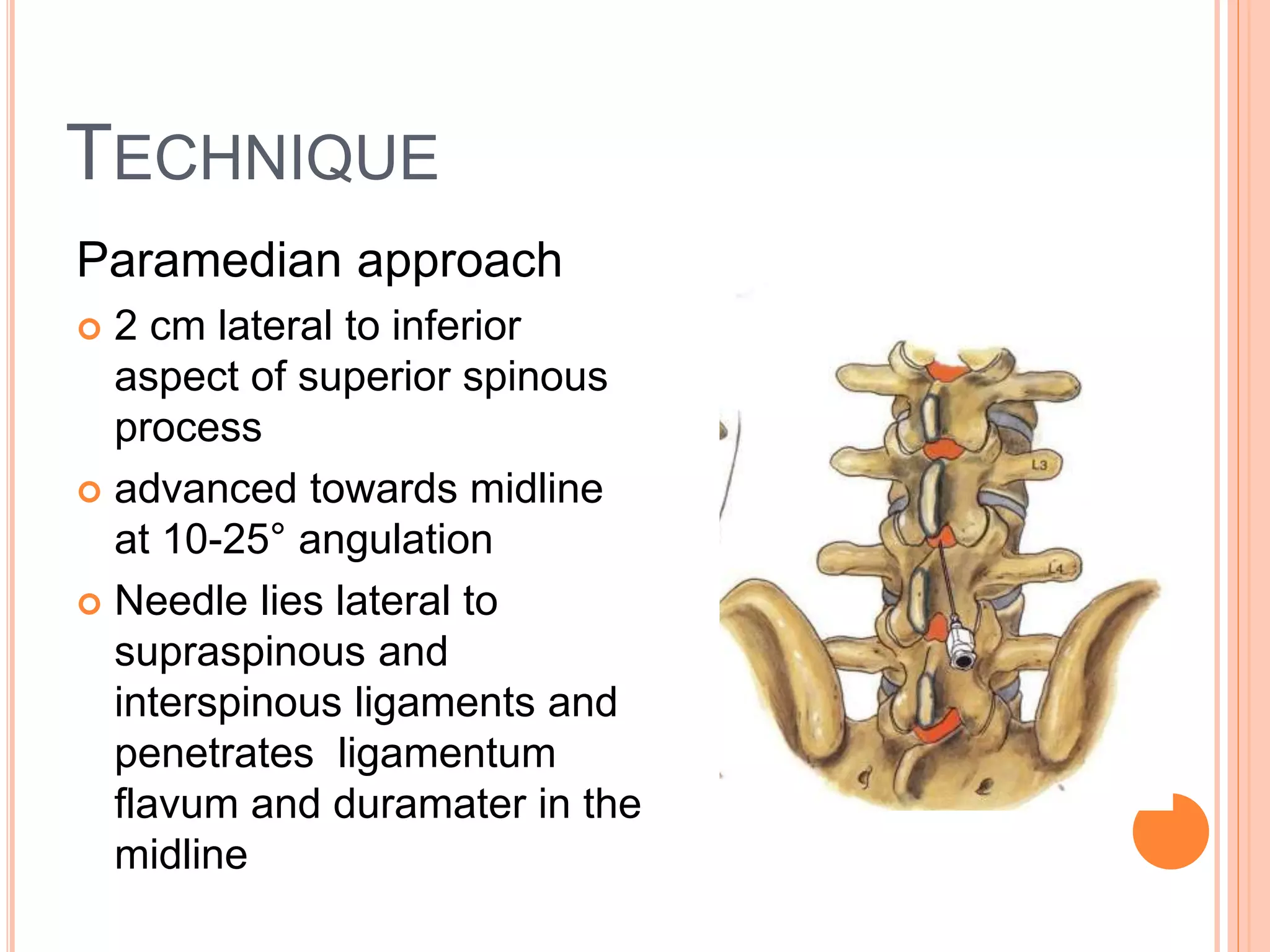 Neuraxial anaesthesia | PPTX