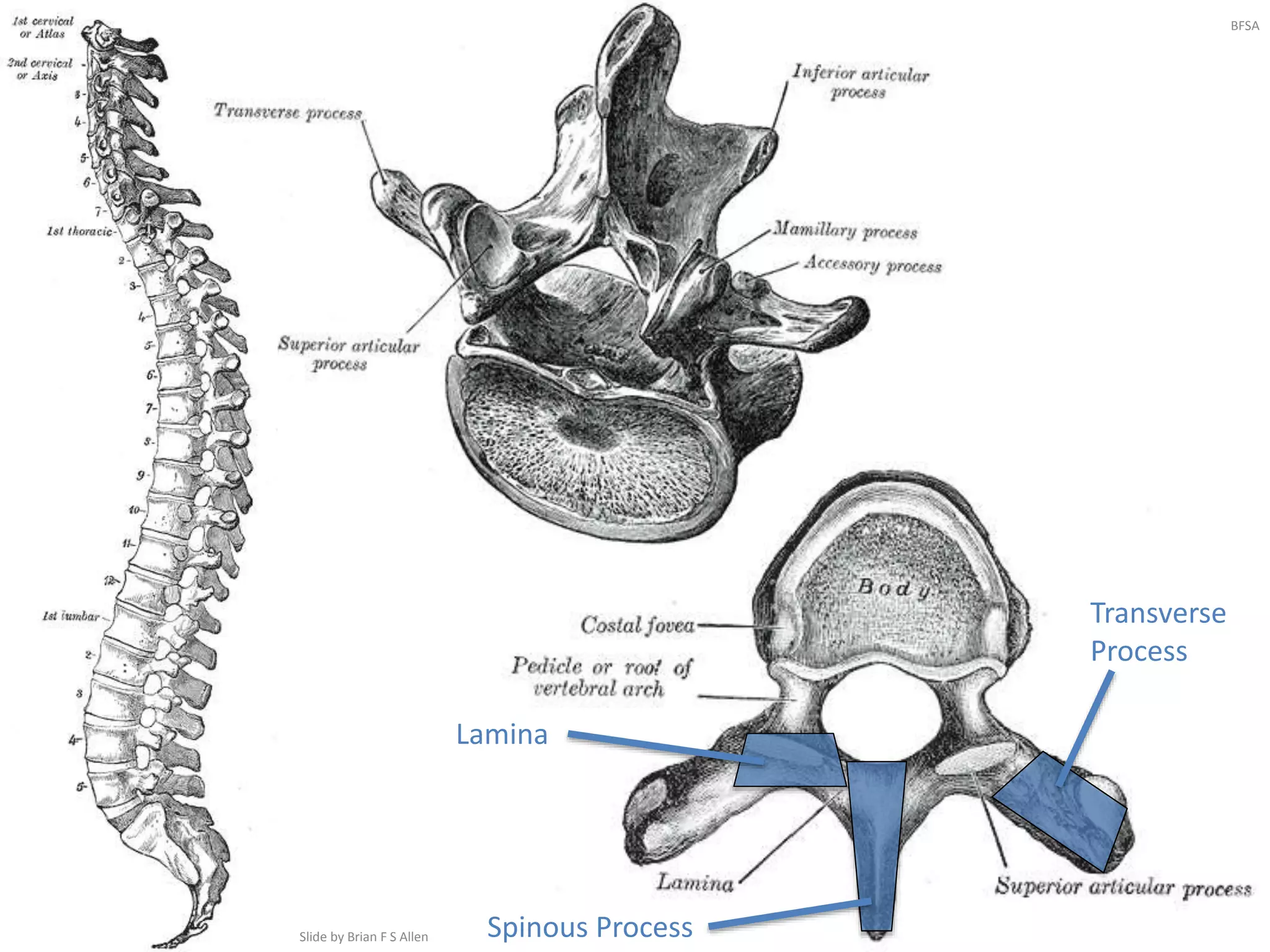 Neuraxial and Truncal Regional Anesthesia | PPTX