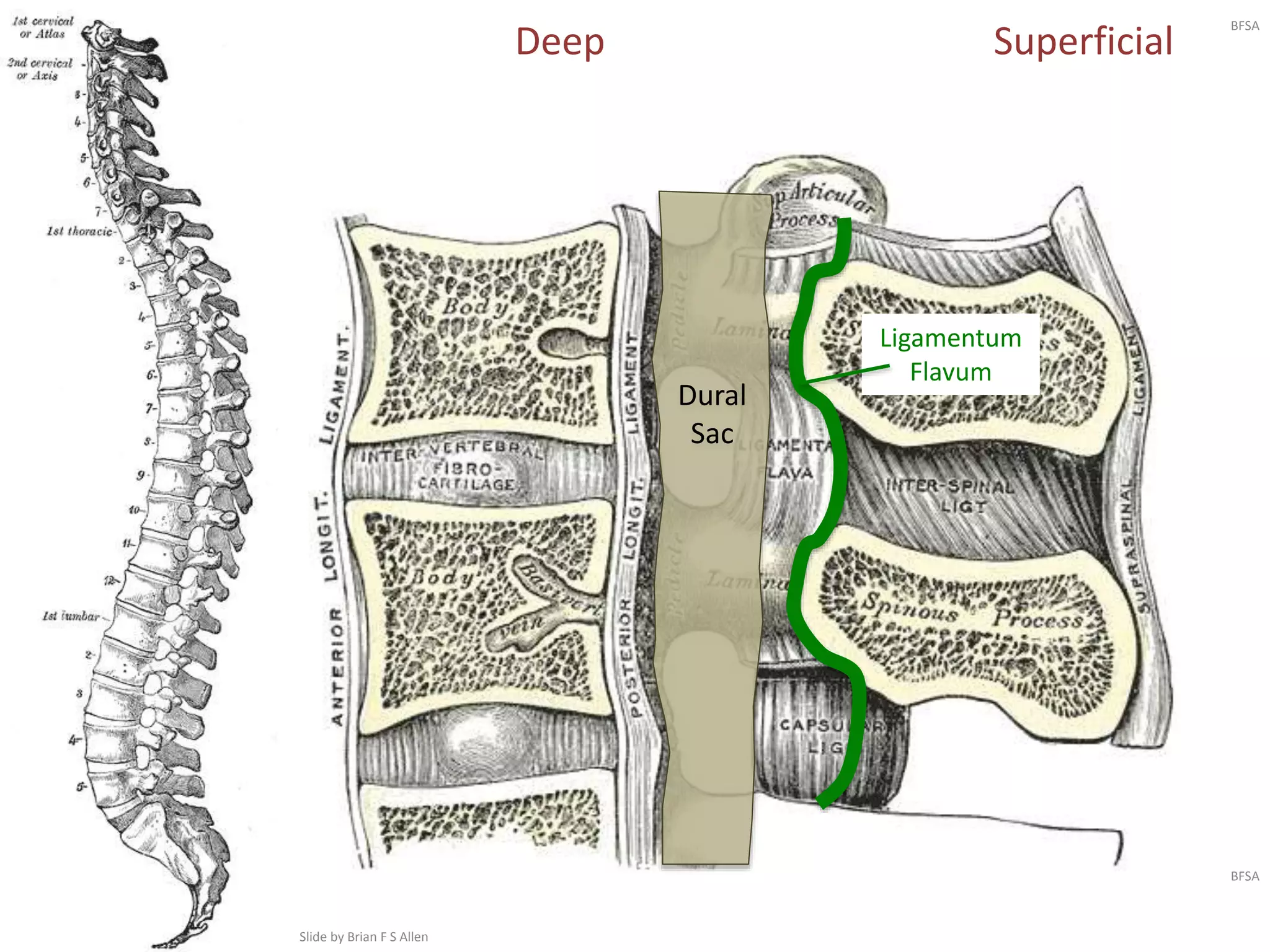 Neuraxial and Truncal Regional Anesthesia | PPTX