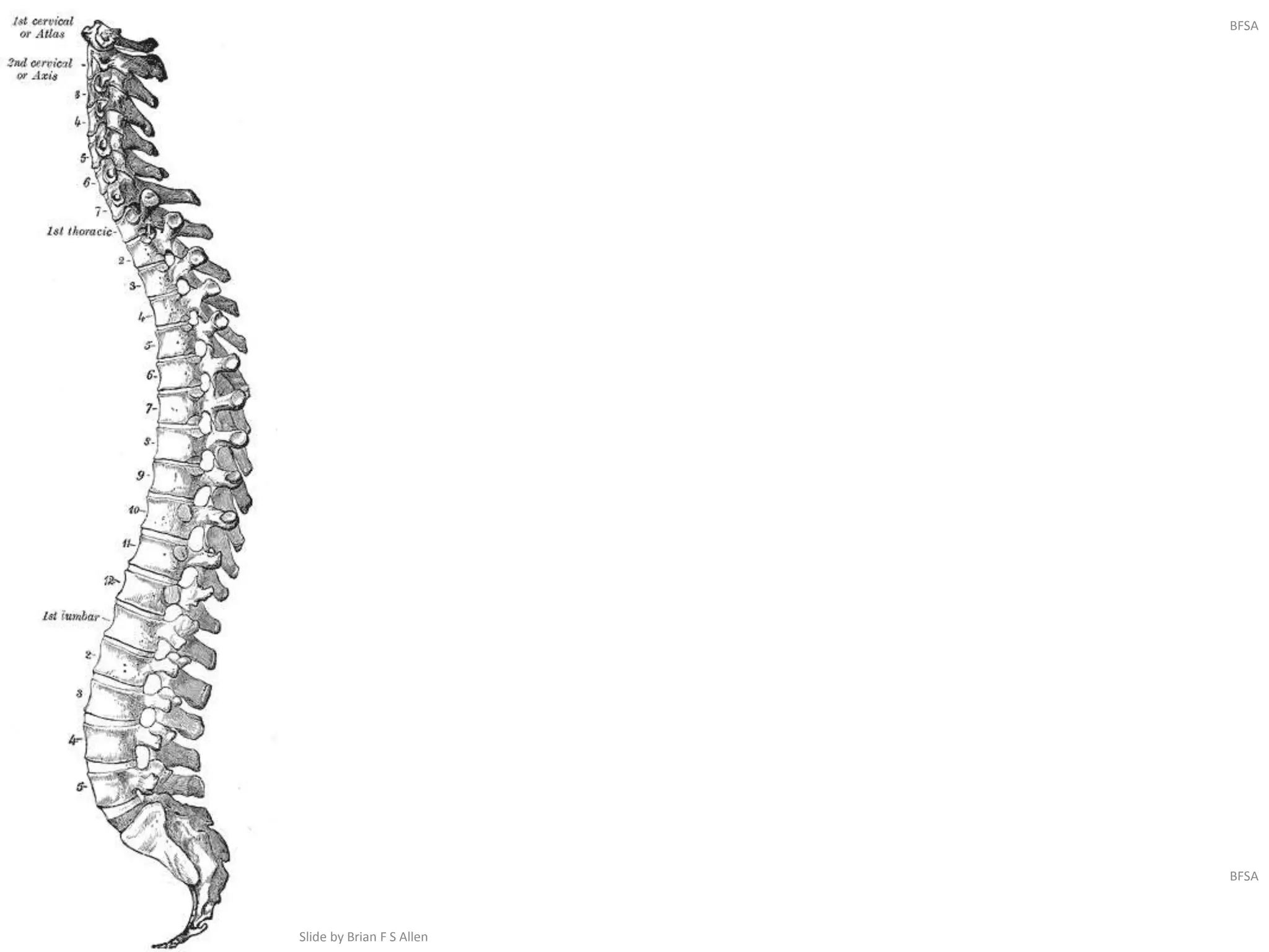 Neuraxial and Truncal Regional Anesthesia | PPTX