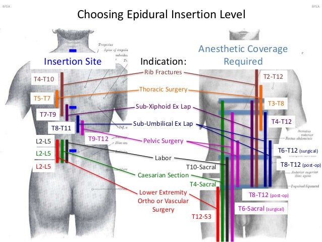 Neuraxial and Truncal Regional Anesthesia