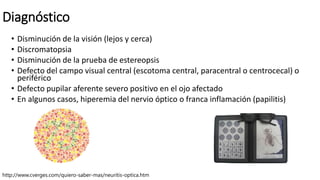 Neuritis optica | PPTX
