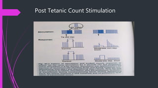 Neurmuscular monitoring | PPTX