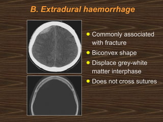 Neuro clinics 16 ct scan for icu settings | PPT | Death, Injury, or ...