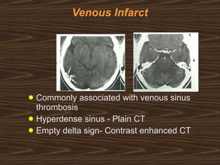 Neuro clinics 16 ct scan for icu settings | PPT | Death, Injury, or ...