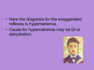 Neuro clinics 57 hyper-reflexia | PPT