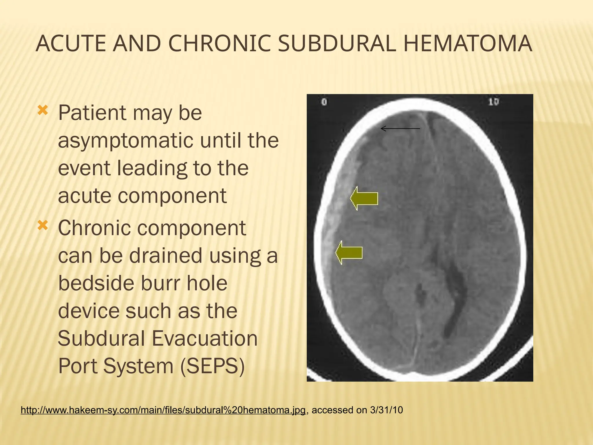 Neuro imaging for computed tomography -CT.pptx