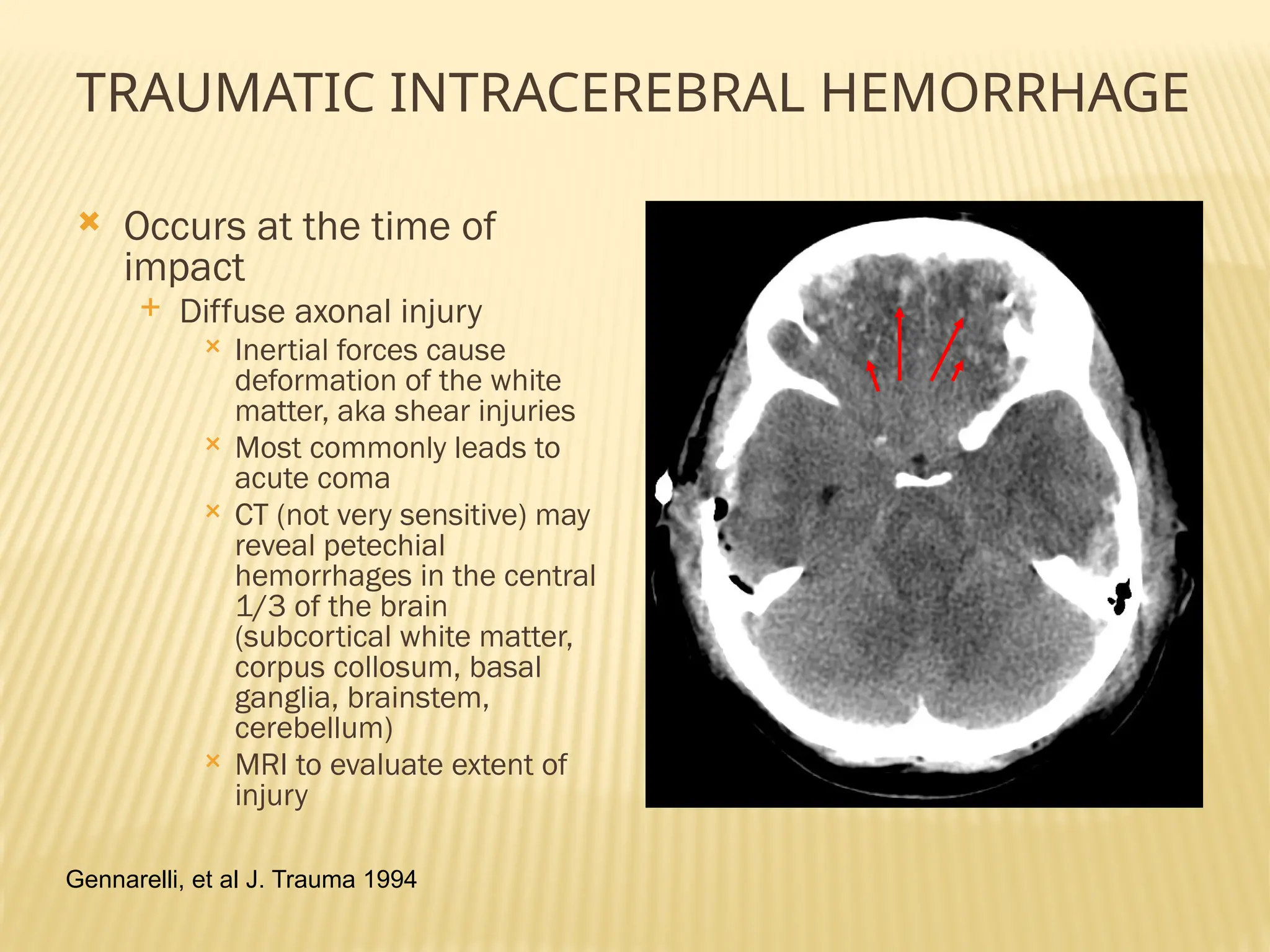 Neuro imaging for computed tomography -CT.pptx