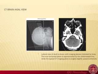 Neuro imaging for computed tomography -CT.pptx