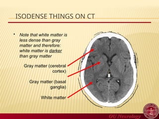 Neuro imaging for computed tomography -CT.pptx