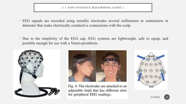 NEURO-ELECTRIC PROSTHESIS- NEUROPROSTHESIS | PPT