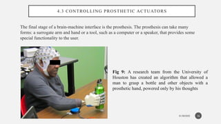 NEURO-ELECTRIC PROSTHESIS- NEUROPROSTHESIS | PPT
