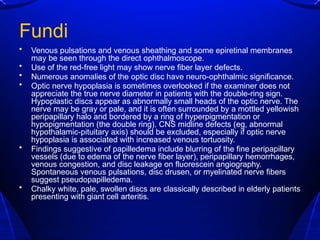 Neuro-Ophthalmic examination by Riyad Banayot.pptx