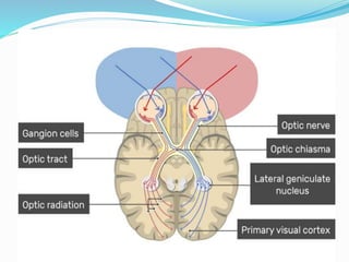 Neuro ophthalmology | PPTX