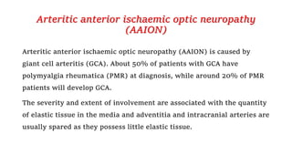 Neuro ophthalmology | PPTX