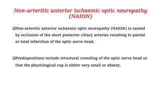 Neuro ophthalmology | PPTX