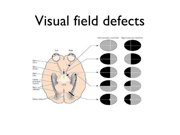 Introduction to Neuro-ophthalmology