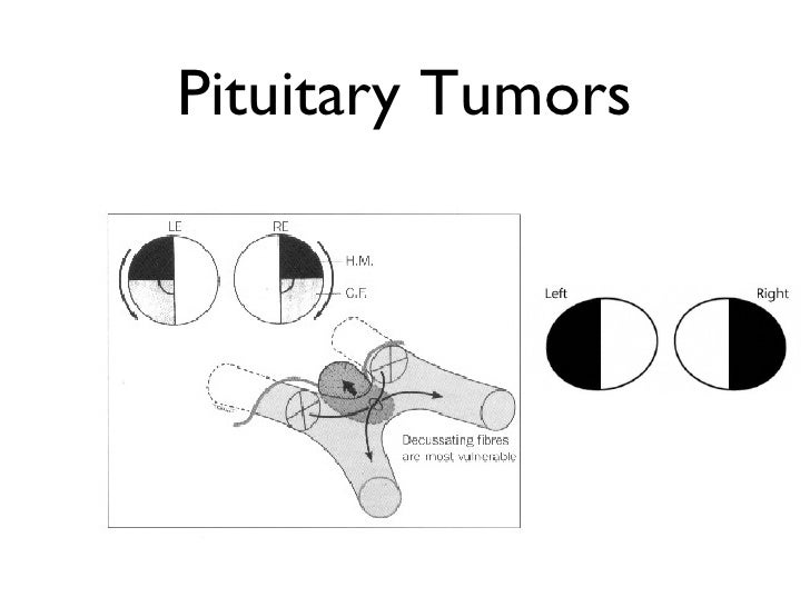 Introduction to Neuro-ophthalmology