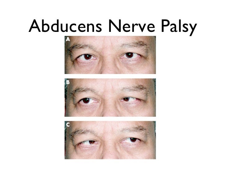 Introduction to Neuro-ophthalmology