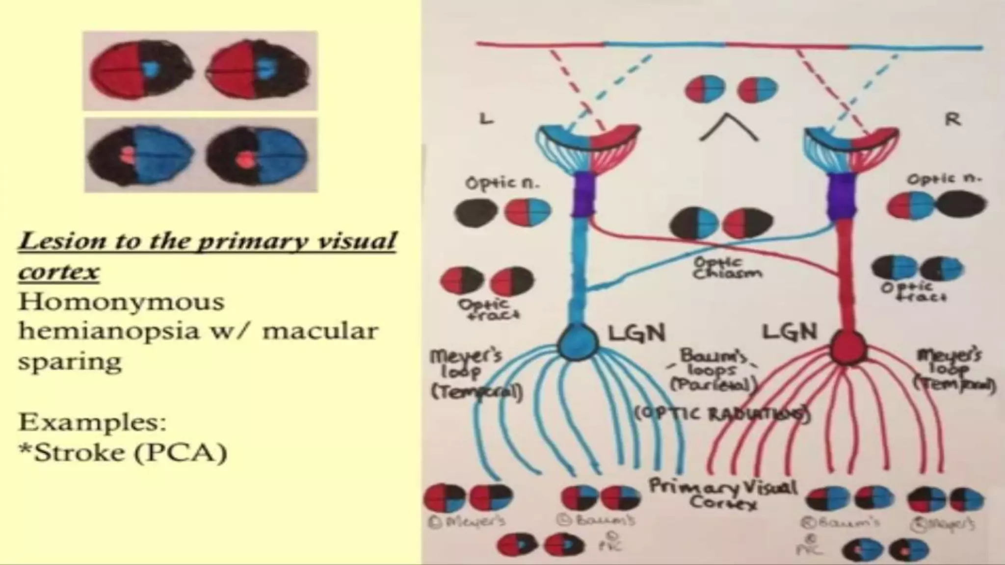 Neuro opthalmology | PPTX