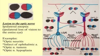 Neuro opthalmology | PPT