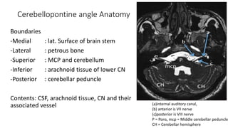Cerebellopontine Angle Anatomy Ppt