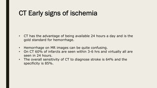 NEURO-RAD for clinical medicine students | PPT