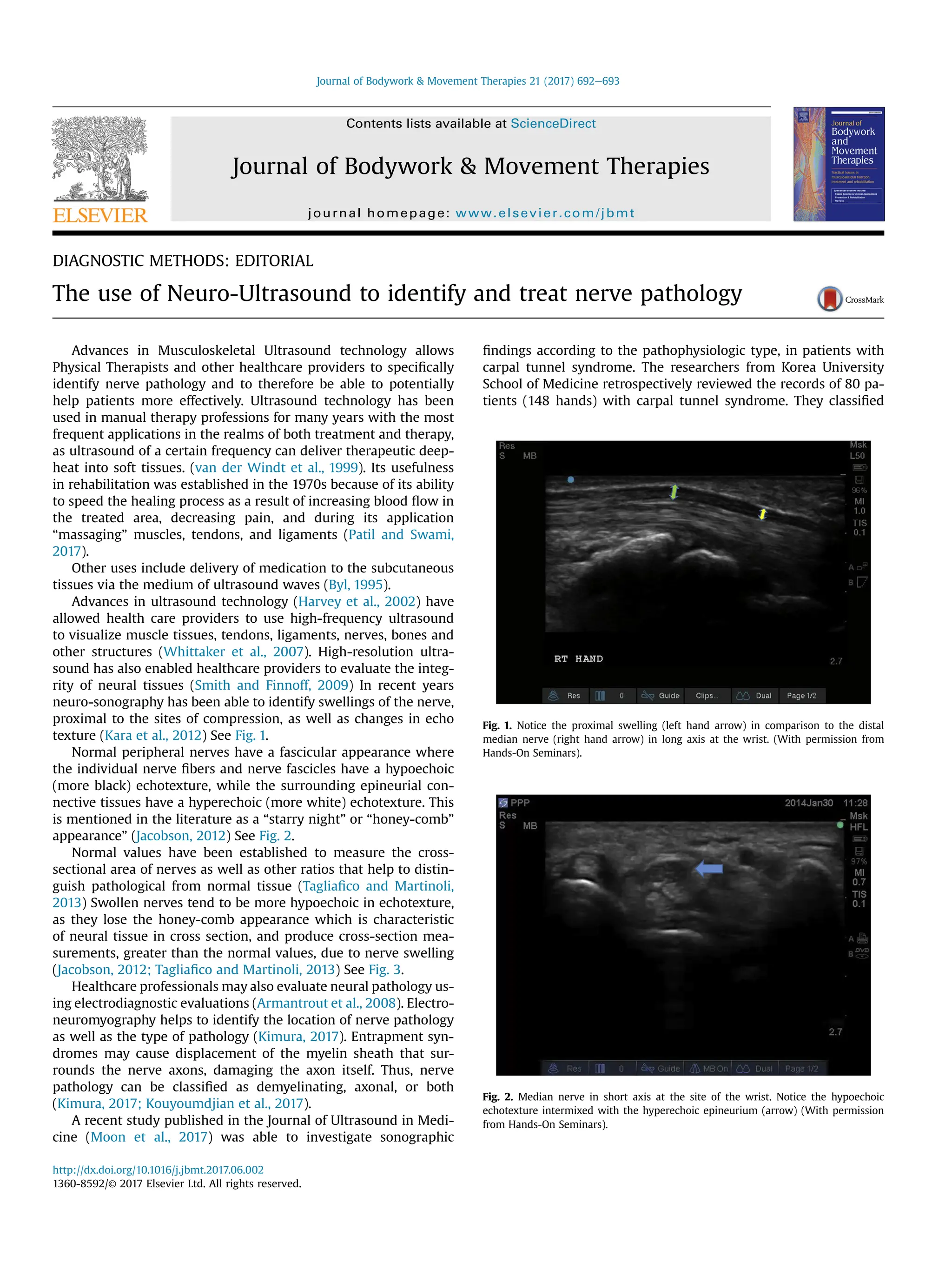 Neuro-Ultrasound-and-Nerve-Pathology-Article (1).pdf