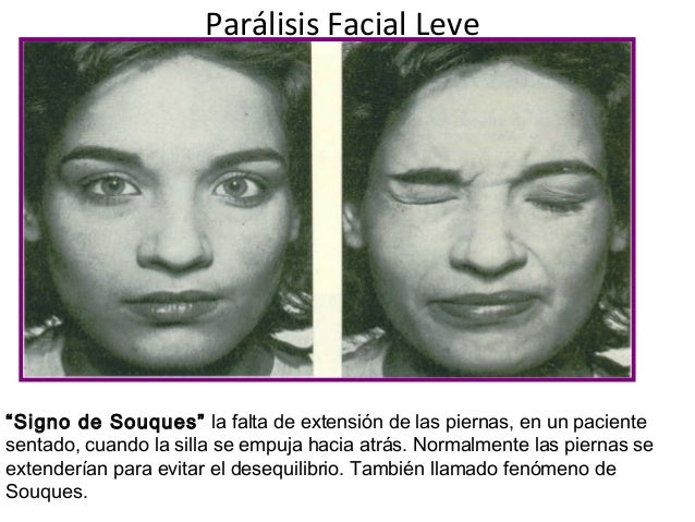 Neuro 2008 ii parte blanco y negro