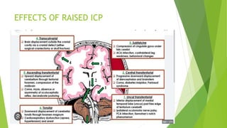 NEUROCRITICAL CARE BASICS ANATOMY25M.pptx