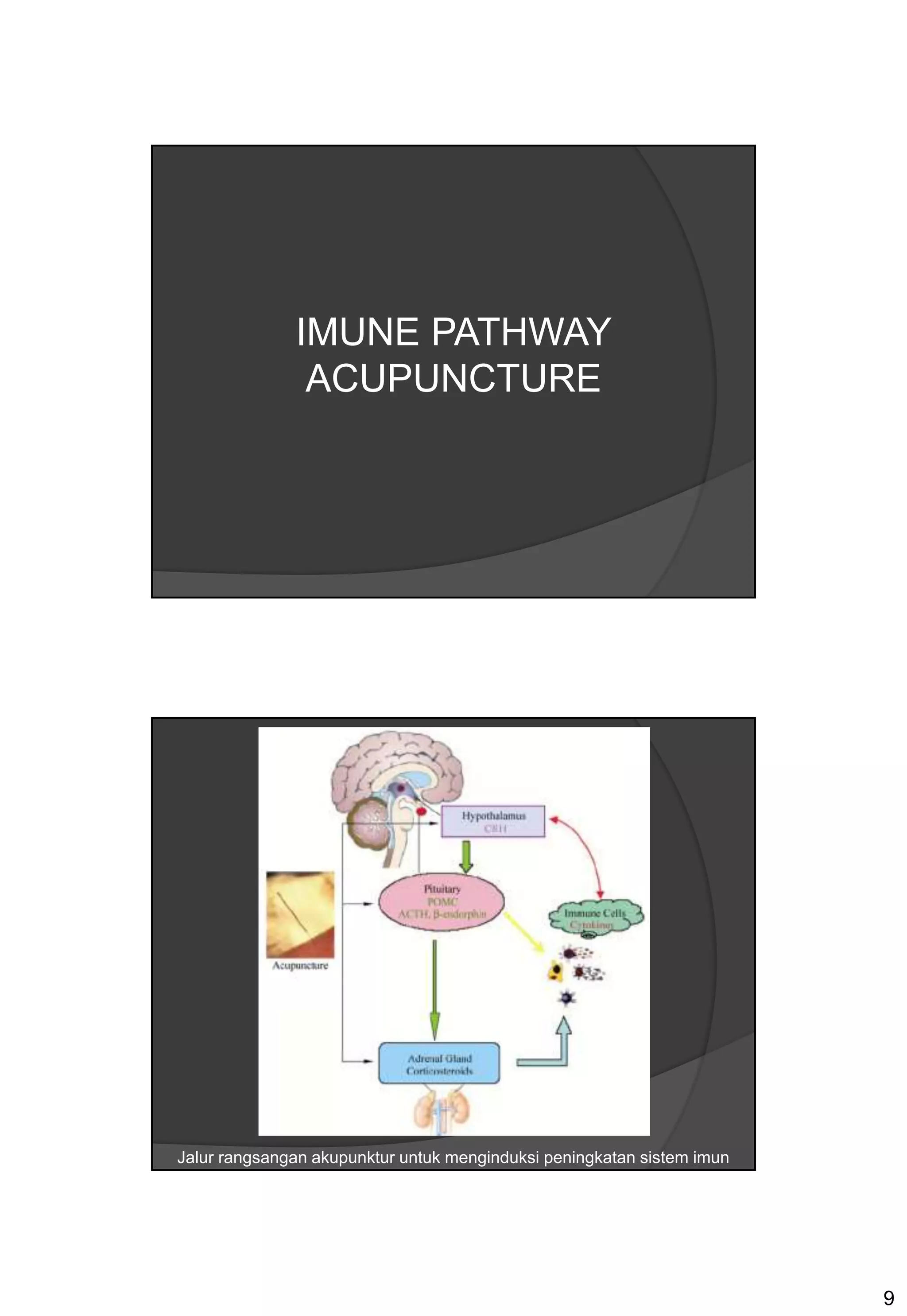 Neuro acupuncture | PDF